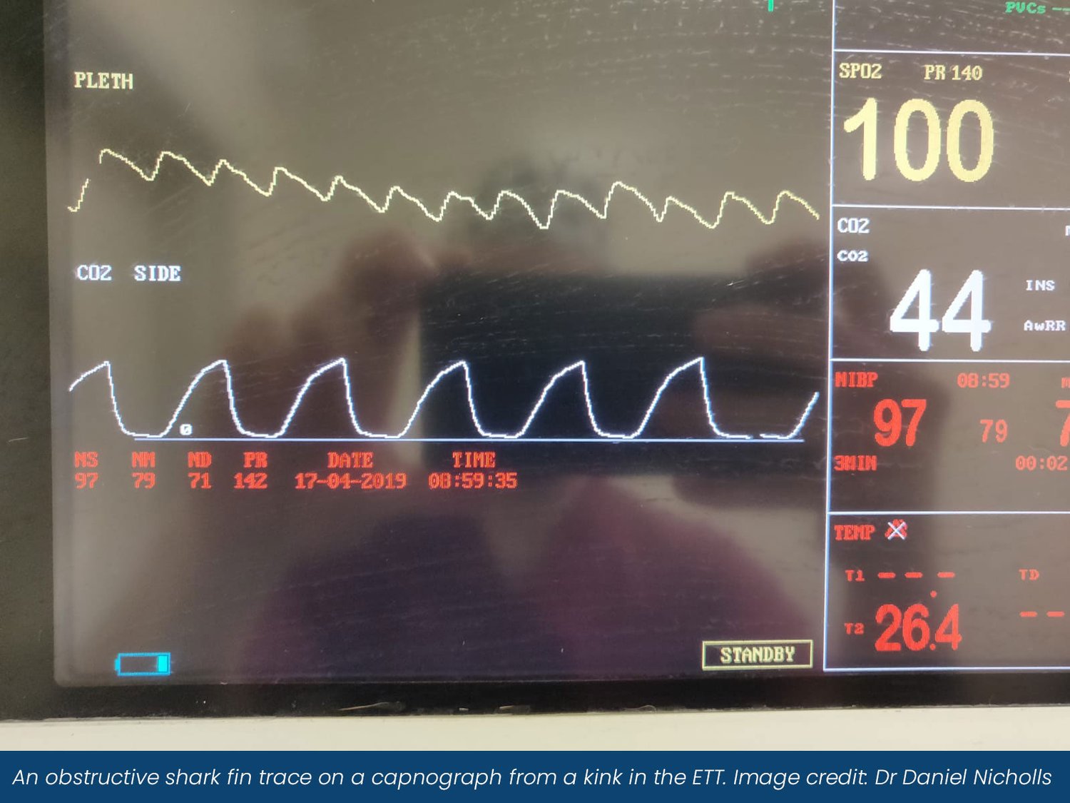 Anaesthesia for the Dental Patient