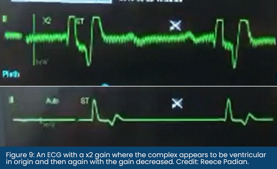 ECGs: Getting a Trustworthy Trace