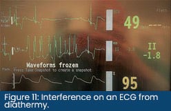 ECGs: Getting a Trustworthy Trace