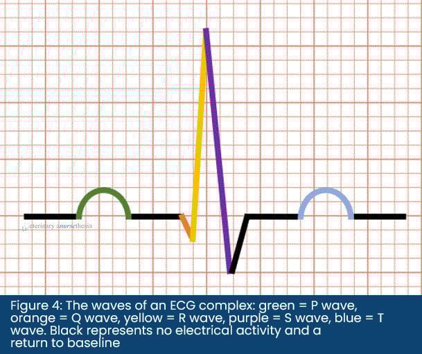 ECGs: Getting a Trustworthy Trace