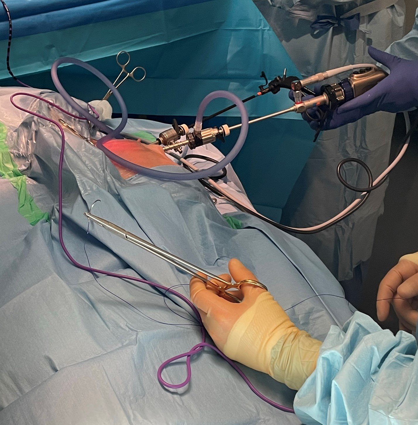 Anaesthesia for the Laparoscopic Patient